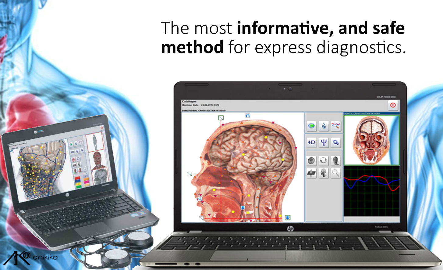 QUANTUMBIO SYSTEMS AND BIORESONANCE
